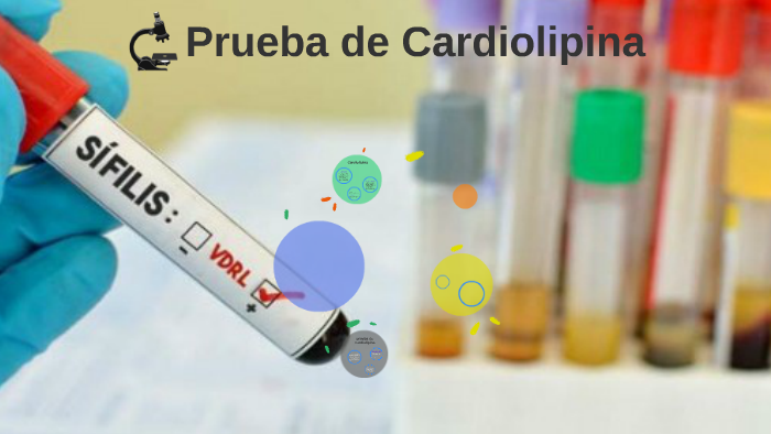 Prueba de Cardiolipina by Esmeralda Leiva on Prezi