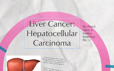 Liver Cancer: Hepatocellular by Patrick Alano on Prezi