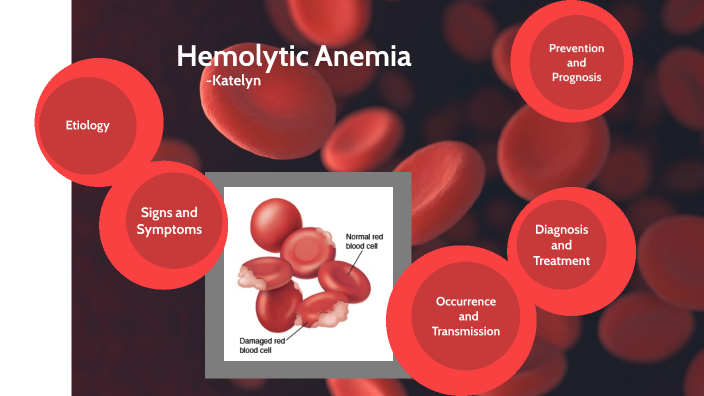 Hemolytic Anemia by Katelyn Kluender on Prezi
