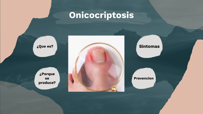 onicocriptosis by romina chandia on Prezi