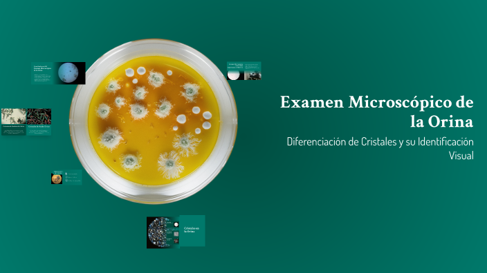 Examen Microscópico de la Orina by Regina Garcia on Prezi