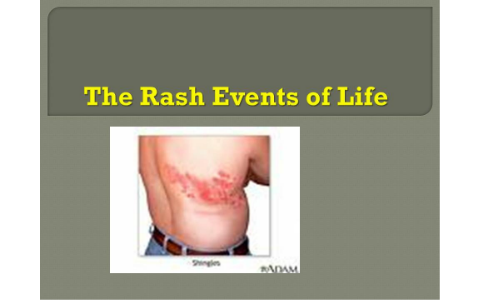 The Rash Events of Life by jone Tiffany on Prezi