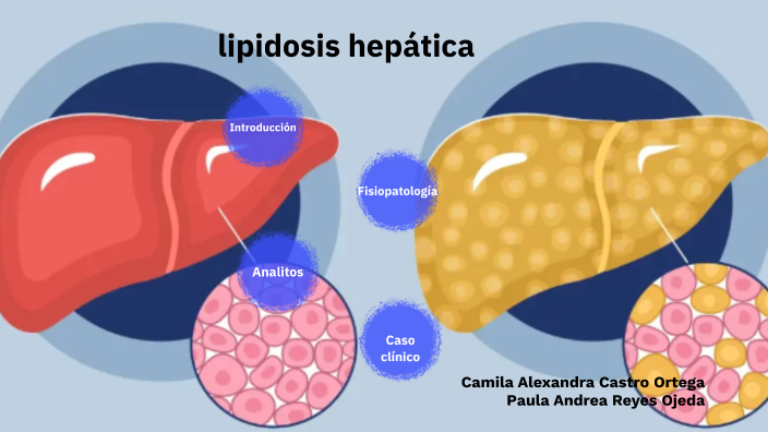 EXPO. LIPIDOSIS HEPÁTICA by Camila Castro on Prezi