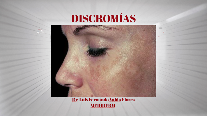 DISCROMIAS by Daniela Mantilla on Prezi