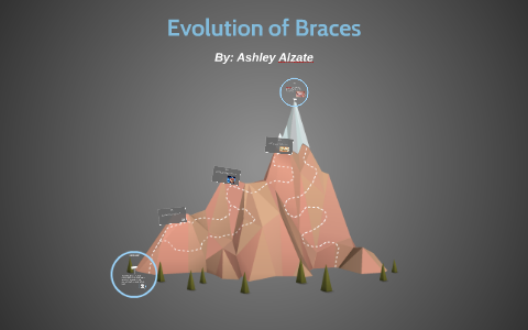 Evolution of Braces by Ashley Alzate-Perez on Prezi