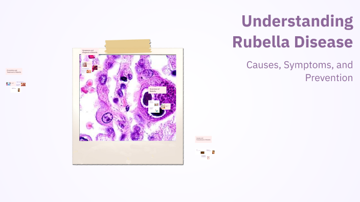 Understanding Rubella Disease by me b on Prezi