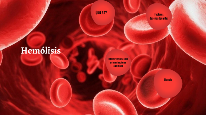 Hemólisi by Judit Lopez on Prezi