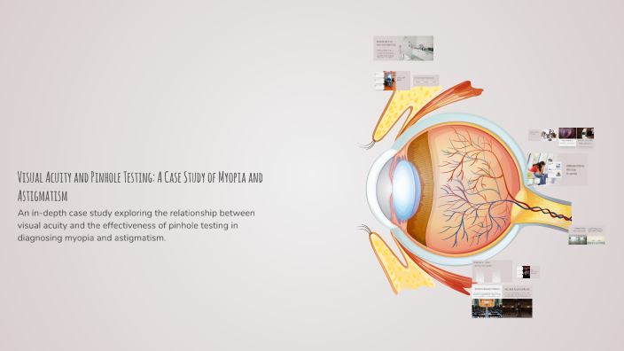 Visual Acuity and Pinhole Testing: A Case Study of Myopia and ...