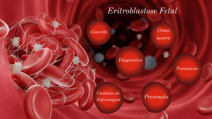 eritroblastose fetal by karoline moreira vieira on Prezi