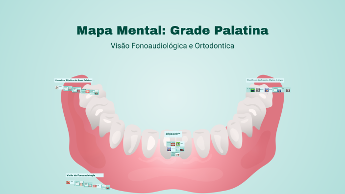 Mapa Mental: Grade Palatina by Juliana Almeida on Prezi