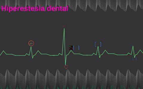 Hiperestesia dental by Cristian Baños Yelmo on Prezi