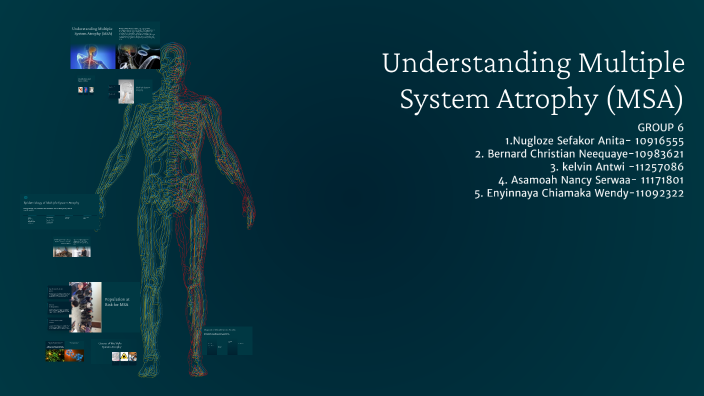 Understanding Multiple System Atrophy (MSA) by Wendy Enyinnaya on Prezi