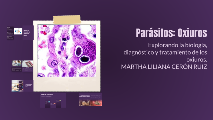 Parásitos: Oxiuros by Martha Liliana Ceron on Prezi