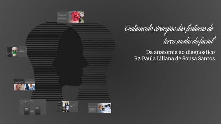Anatomia e Diagnóstico do Terço Médio da Face by Paula SANTOS on Prezi