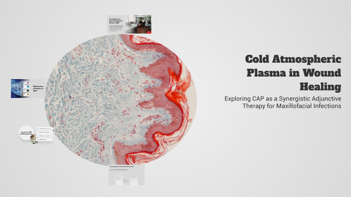 Cold Atmospheric Plasma in Wound Healing by Amira Sabry on Prezi