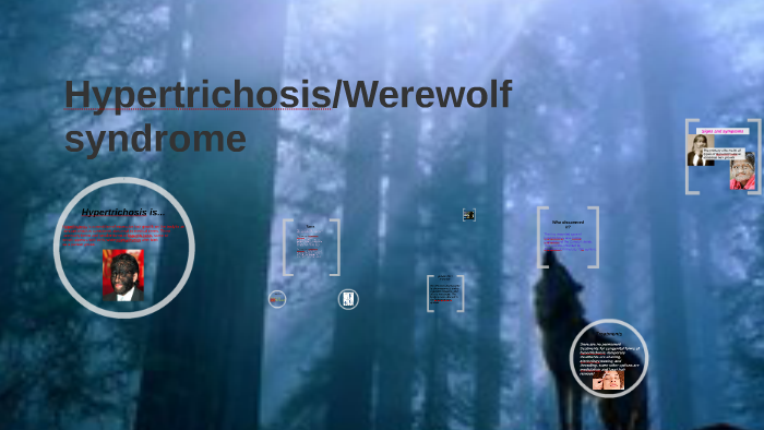 Hypertrichosis/Werewolf syndrome by jessica angelo on Prezi