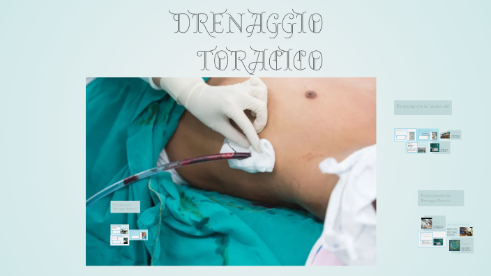 DRENAGGIO TORACICO by FILOMENA LA FEMINA on Prezi