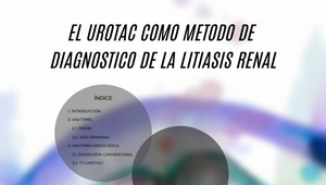 EL UROTAC COMO MÉTODO DE DIAGNÓSTICO DE LA LITIASIS RENAL by pablo ...
