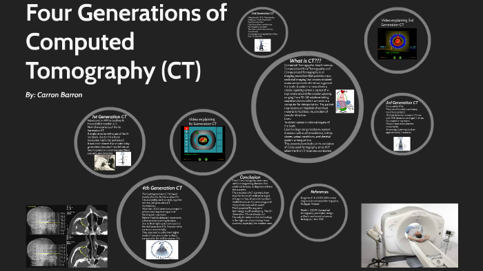 Four Generations of Computed Tomography (CT) by Carron Barron on Prezi