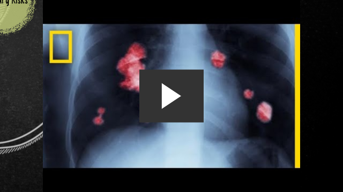 Reducing Your Risk of Cancer by Kimberly Minter-Verge on Prezi