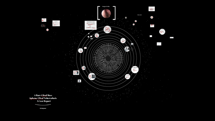 A rare clival mass by Vivek B on Prezi