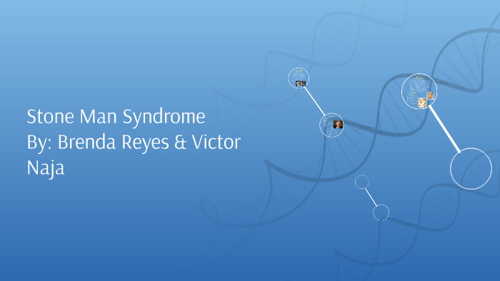 Stone Man Syndrome by Brenda Reyes on Prezi