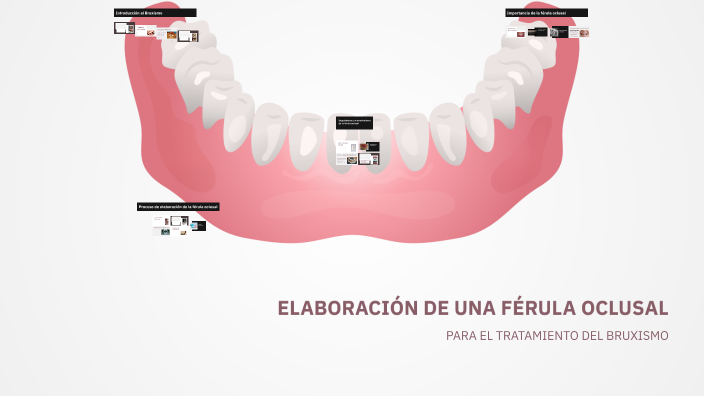 ELABORACIÓN DE UNA FÉRULA OCLUSAL by ALICIA ORTA CRUZ on Prezi