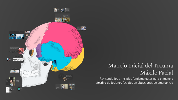 Manejo Inicial del Trauma Máxilo Facial by Jhoss Kiss on Prezi
