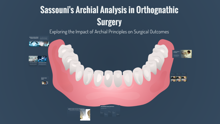 Sassouni's Archial Analysis in Orthognathic Surgery by DrAbdullah ...