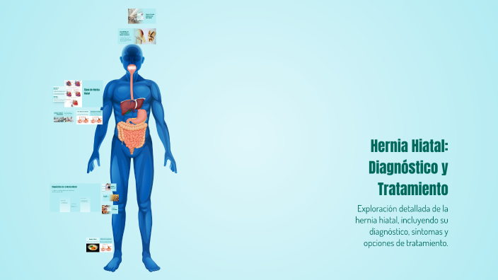 Hernia Hiatal: Diagnóstico y Tratamiento by Sergio on Prezi