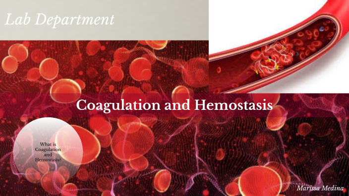 Coagulation and Hemostasis by Marissa M on Prezi
