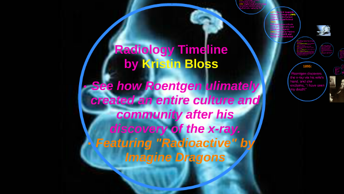 Radiology Timeline by Kristin Bloss on Prezi