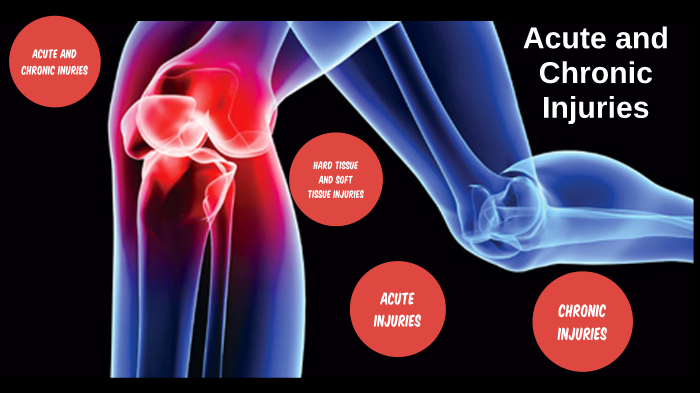 Acute and Chronic Injuries by Harriet Carter on Prezi