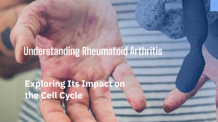 Rheumatoid Arthritis and Cell Cycle by isabella rivera on Prezi