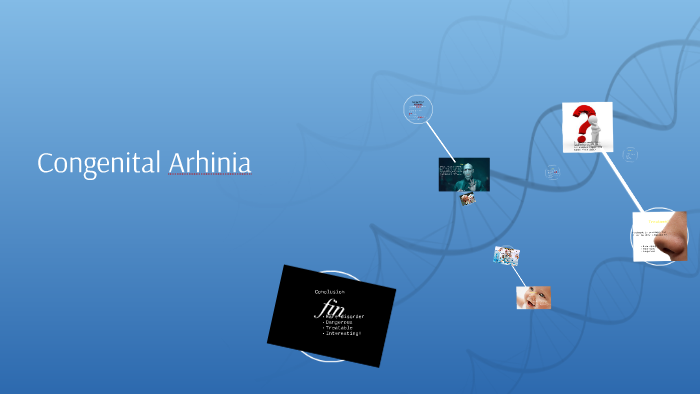 Congenital Arhinia by Science Project on Prezi