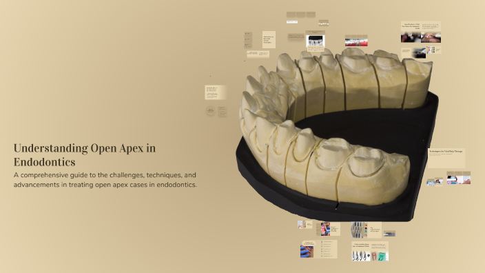 Understanding Open Apex in Endodontics by ezzaldeen f qamhan on Prezi