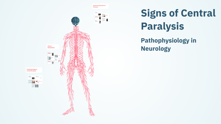 Signs of Central Paralysis by Anya Sinianskaya on Prezi
