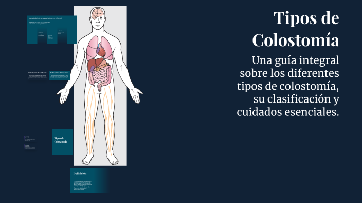 Tipos de Colostomía by Adal Ortiz on Prezi