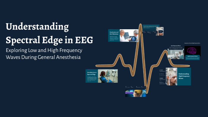 Understanding Spectral Edge in EEG by Kathryn Rosenblatt on Prezi
