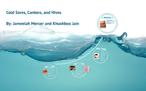 Cold Sores, Cankers, and Hives by Jameelah Mercer on Prezi