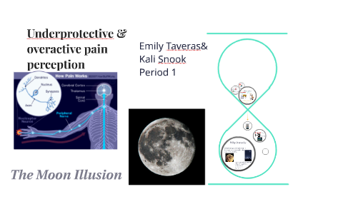 Underprotective & overactive pain perception by emily taveras on Prezi