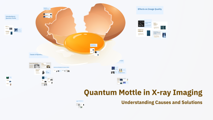 Quantum Mottle in X-ray Imaging by Ali AlZubaidi on Prezi