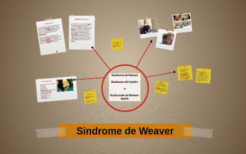 Sindrome de Weaver by Angela Hinostroza on Prezi