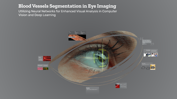 Blood Vessels Segmentation in Eye Imaging by Filippo De Simoni on Prezi