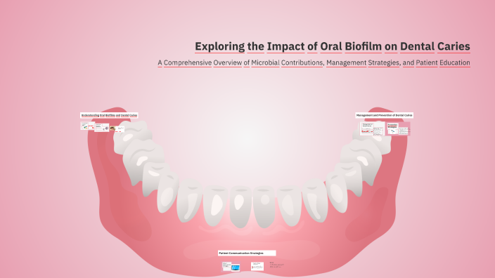 Exploring the Impact of Oral Biofilm on Dental Caries by Sylvie ...