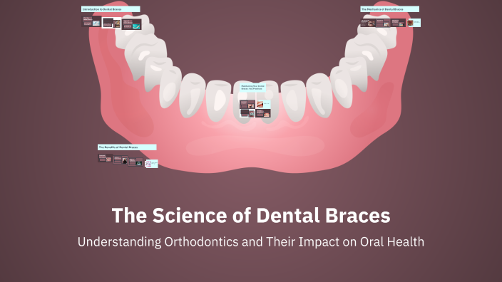 The Science of Dental Braces by Denta Pedia on Prezi