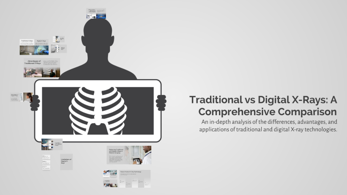 Traditional vs Digital X-Rays: A Comprehensive Comparison by شهد on Prezi