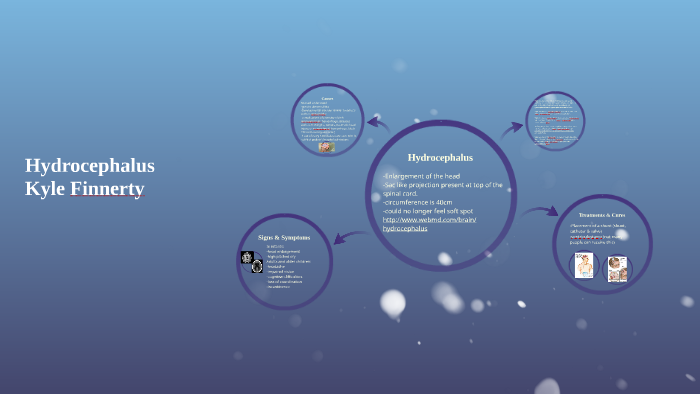 Hydrocephalus by Kyle Finnerty on Prezi