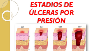 PRESENTACIÓN ESTADIOS DE ÚLCERAS POR PRESIÓN by alejandra chaverra on ...