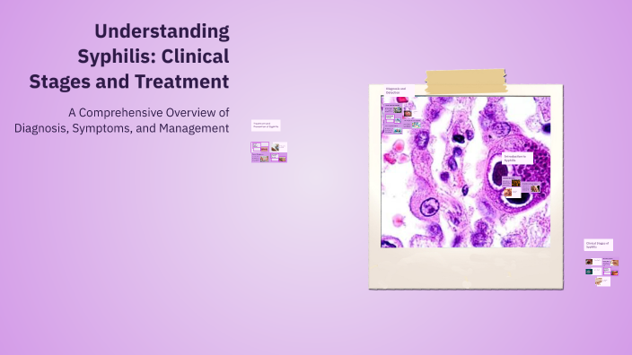 Understanding Syphilis: Clinical Stages and Treatment by Z levin on Prezi